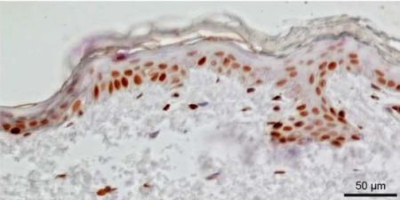 Lipofuscin - Longevity Wiki